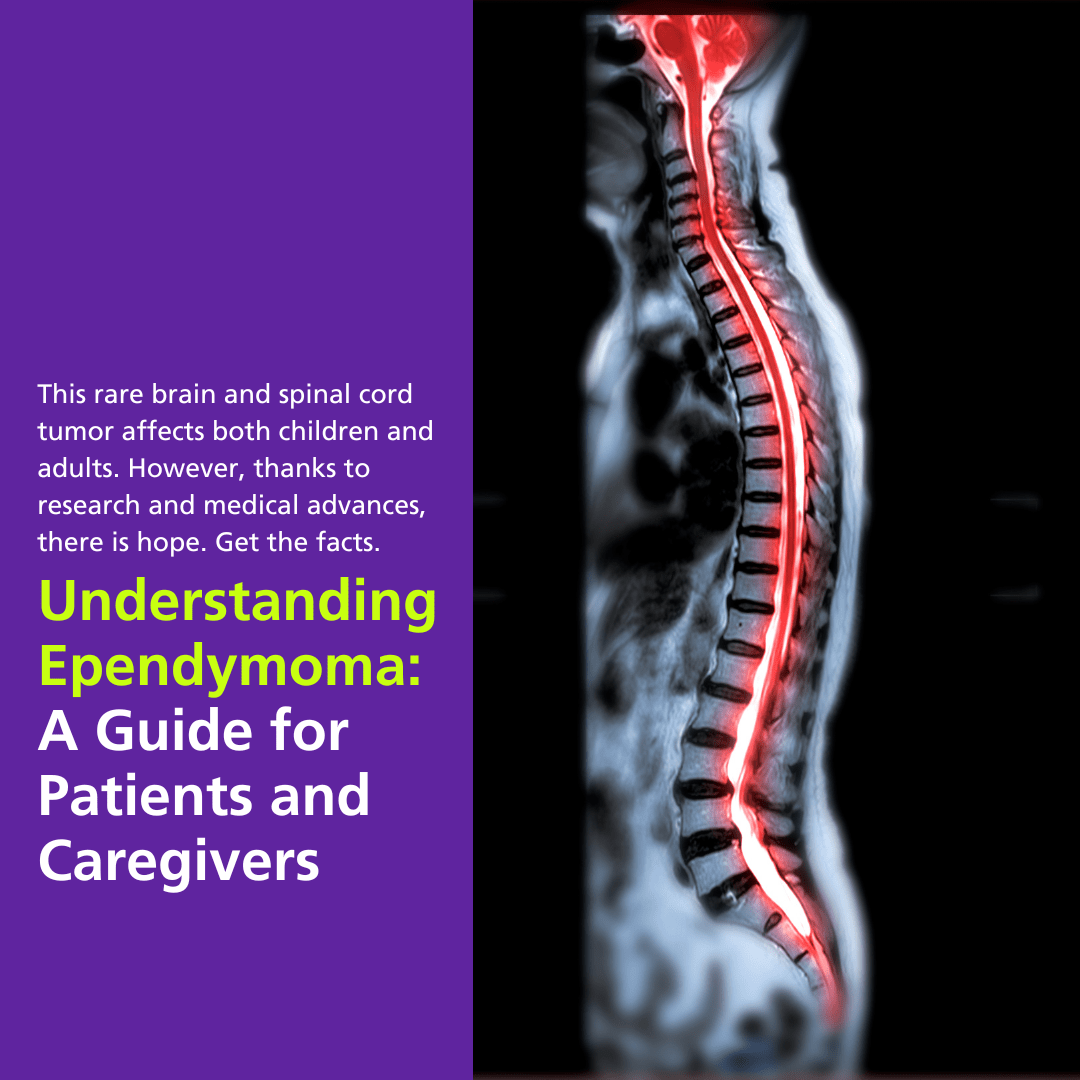 Understanding Ependymoma: A Guide for Patients and Caregivers ...